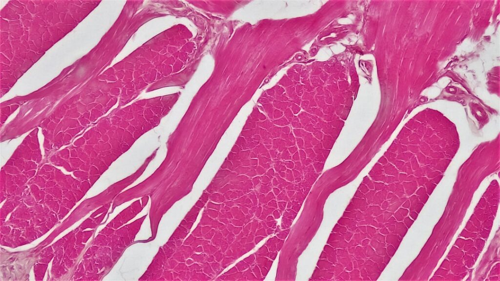 Understanding Muscle Fiber Types: Fast Twitch and Slow Twitch - ACMHA